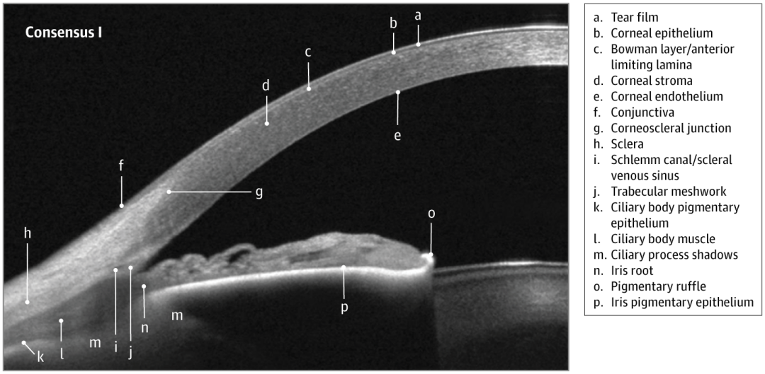 《JAMA Ophthalmology》丨APOSTEL-AS专家小组共识：眼前节OCT成像解剖结构的标准化术语命名医药新闻-ByDrug-一 ...