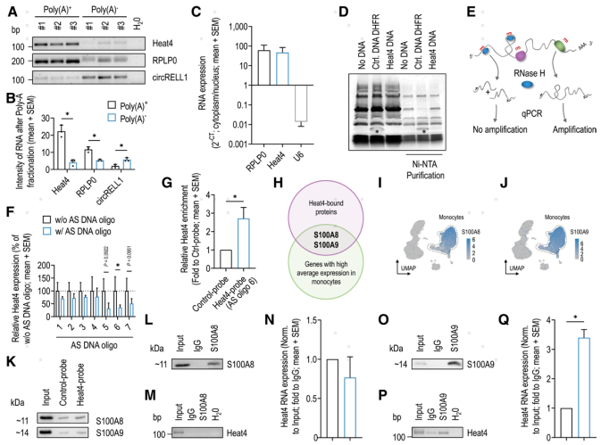 Circulation重磅：心衰治疗新靶点！HEAT4长非编码RNA或成突破口医药新闻-ByDrug-一站式医药资源共享中心-医药魔方