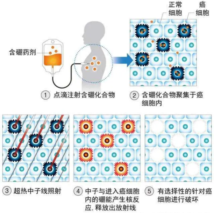 Advanced Materials | PD-L1 siRNA负载的硼纳米颗粒：精准癌症放疗与免疫治疗的新突破医药新闻-ByDrug-一站式医药资源共享中心-医药魔方